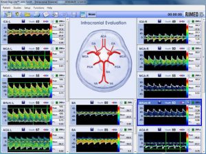 Digi-One™ - Med Rent